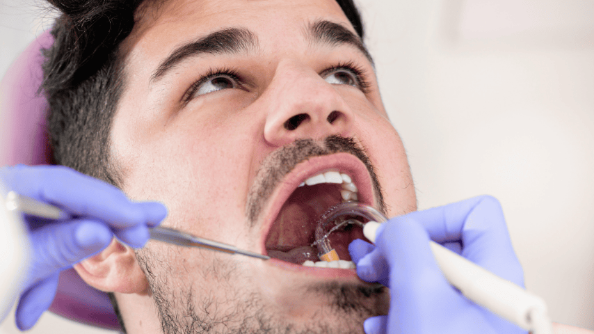 Scaling & Root Planing: Complete Deep Cleaning Guide